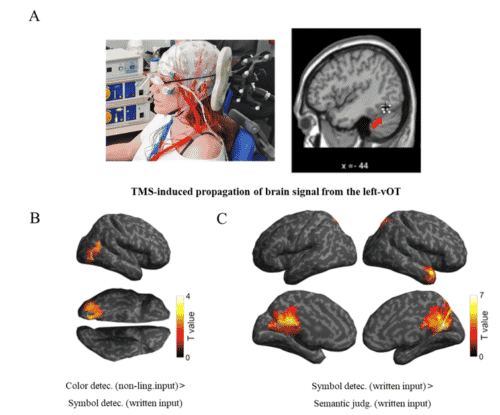 Connectivity of the left-ventral occipitotemporal cortex during visual ...