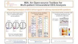 MIA: An open-source toolbox for Multi-patient Intracranial EEG Analysis ...