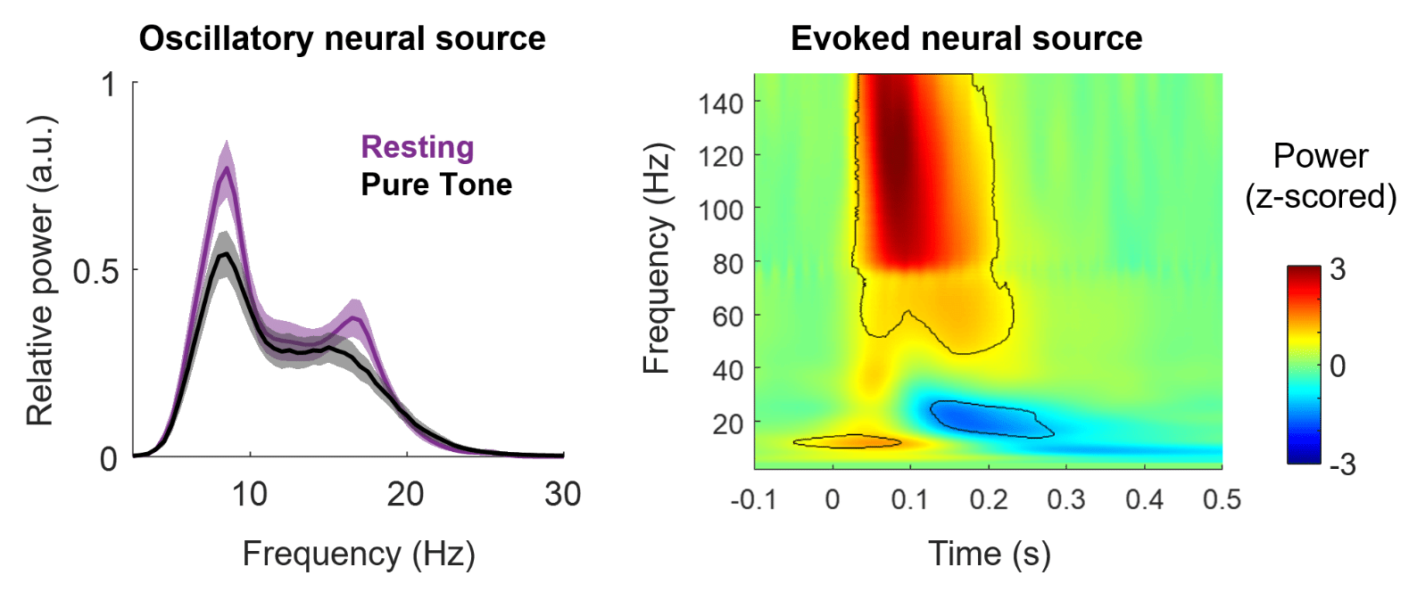 Different sustained and induced alpha oscillation in the human auditory ...